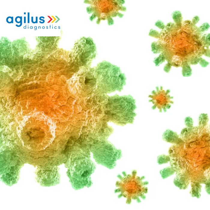 Yellow Fungus - Infection Causes, Symptoms, Treatment - Agilus Diagnostics