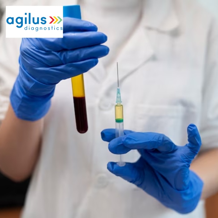 Liver Function Test: When Is It Done, How To Prepare And Other ...