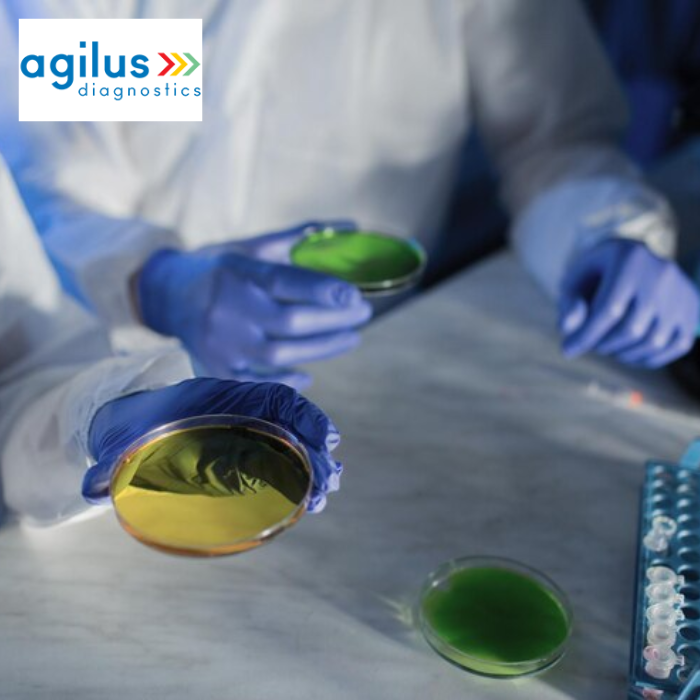 Unlocking The Secrets Of Phosphorus Testing- Why It Matters, Its ...