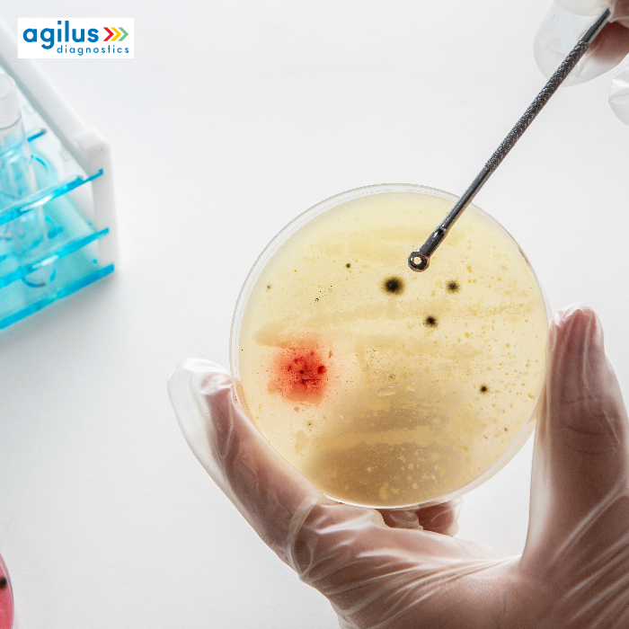 A Complete Guide To: Sputum Culture - Agilus Diagnostics